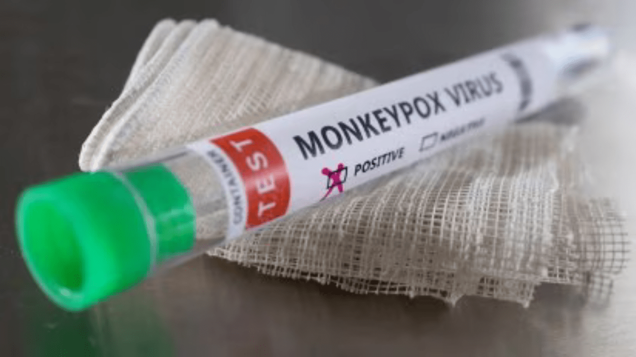 पाकिस्तान में मिला MPOX का पहला केस, जानिए इसके लक्षण और इलाज - Report ...